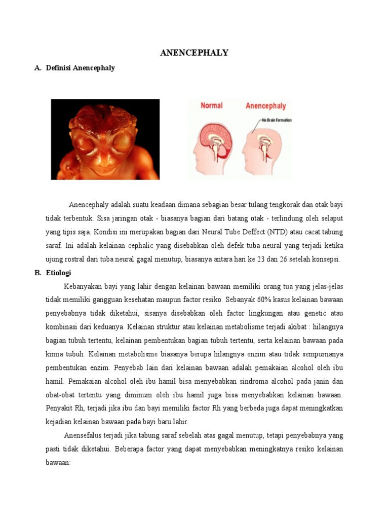 ANENCEPHALY | PDF | Kesehatan Holistik