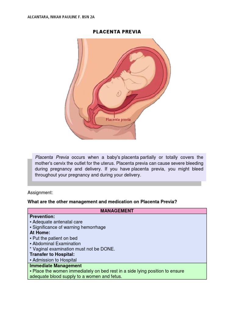 Placenta Previa Management Medication Assignment | PDF | Childbirth ...