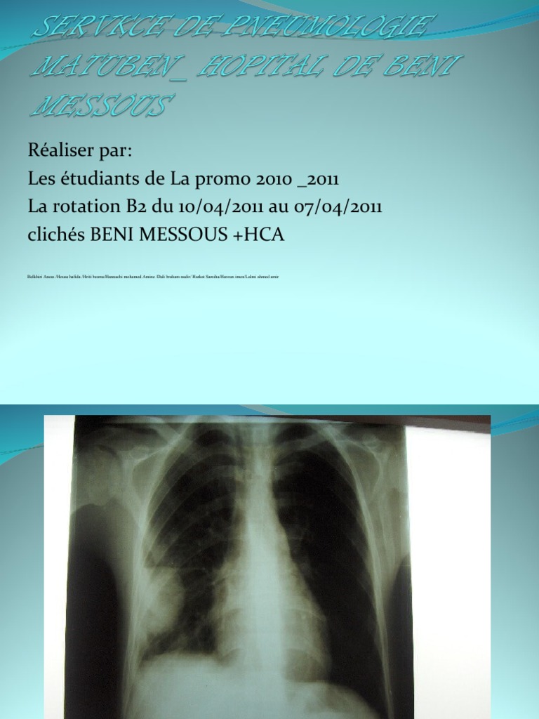 Serie de Radio | PDF | Poumon | Tuberculose