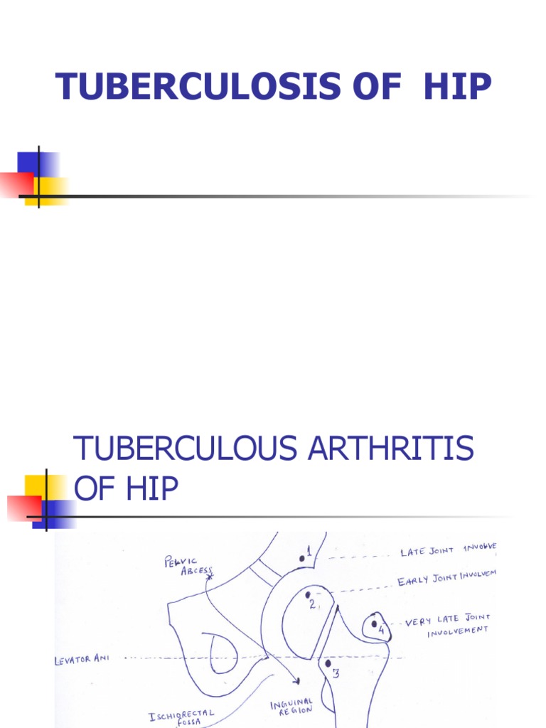 Stages and Management of Hip Tuberculosis | PDF | Hip | Anatomical ...