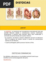 Distocia Funicular | PDF | Parto | Feto