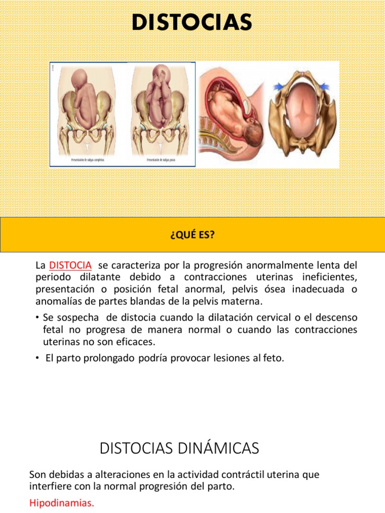 DISTOCIAS | PDF | Parto | La salud de la mujer