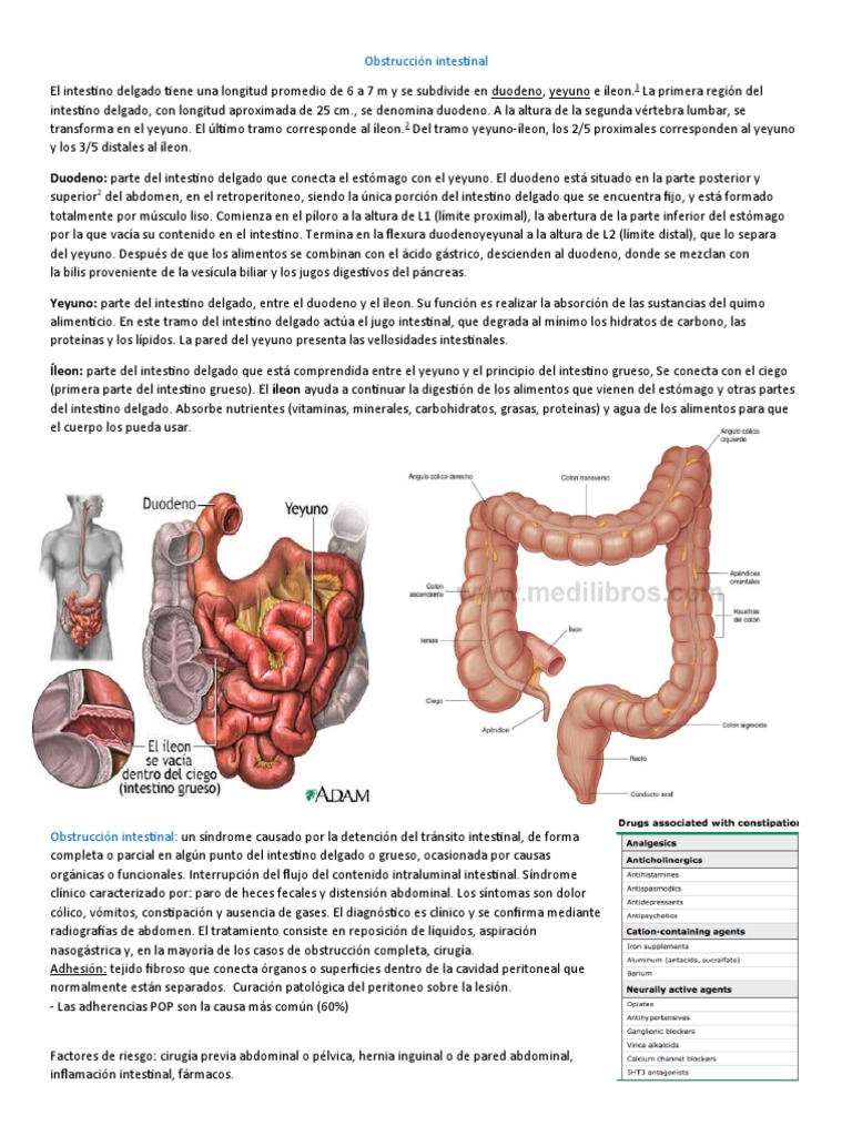Obstrucción Intestinal | PDF | Intestino delgado | Tracto gastrointestinal