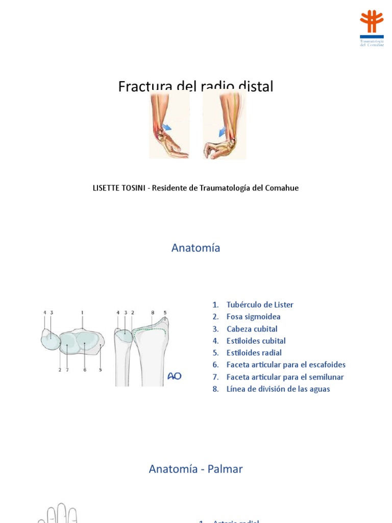 Anatomía y Tratamiento de Fracturas de Radio Distal | PDF | Hueso ...