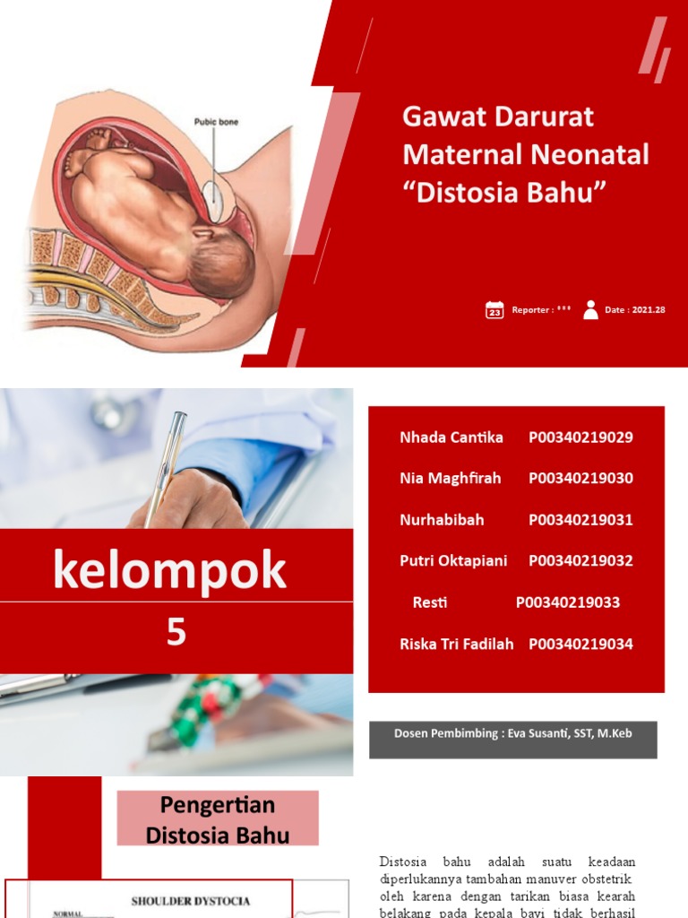 Distosia Bahu k5 Fix | PDF