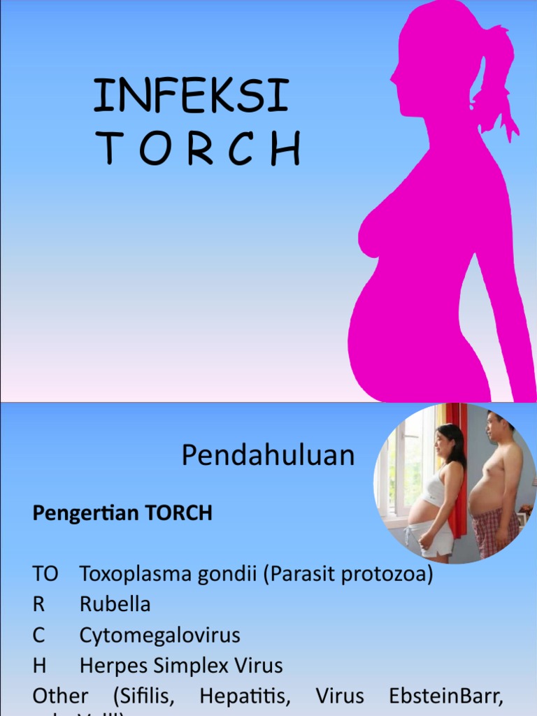 Torch | PDF