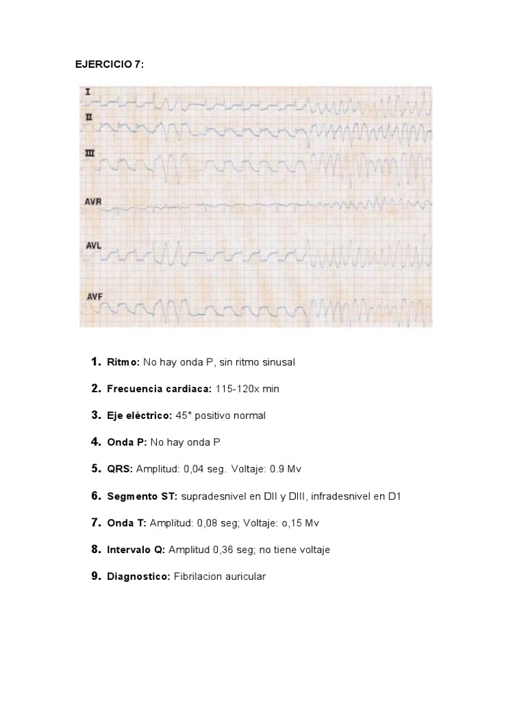 Ejercicio 7 - Fisio Sem | PDF