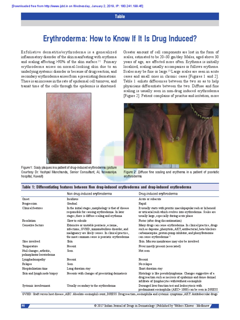 Erythroderma How To Know If It Is Drug Induced | PDF | Psoriasis ...