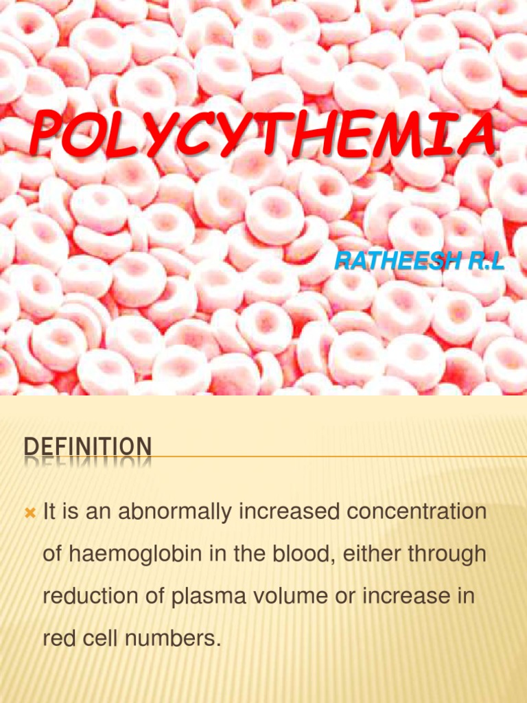 Polycythemia: Ratheesh R.L | PDF | Tissue (Biology) | Diseases And ...