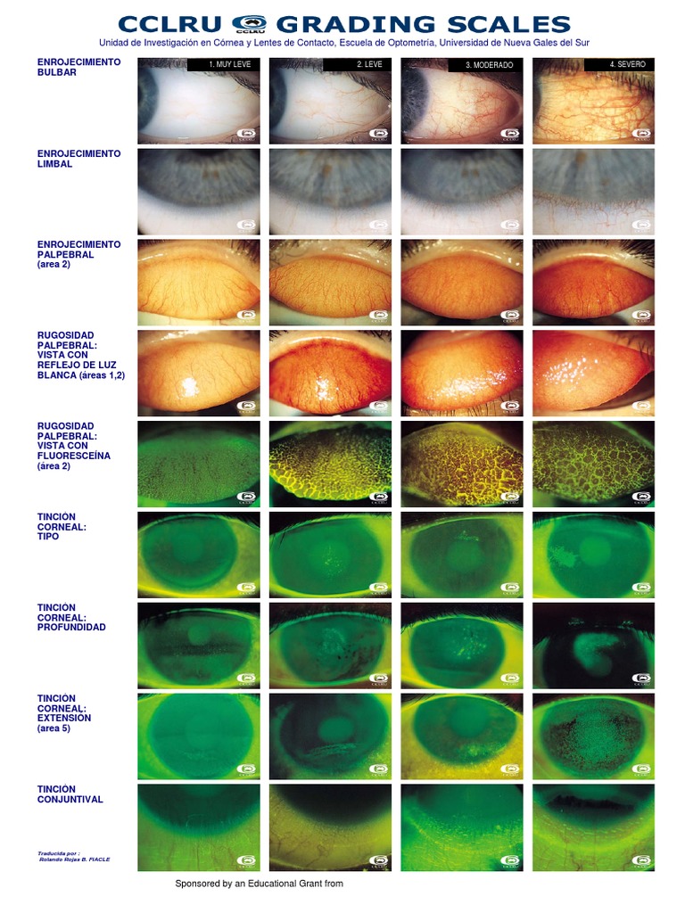 Escala Cclru Traduccion | Descargar gratis PDF | Inflamación | Córnea