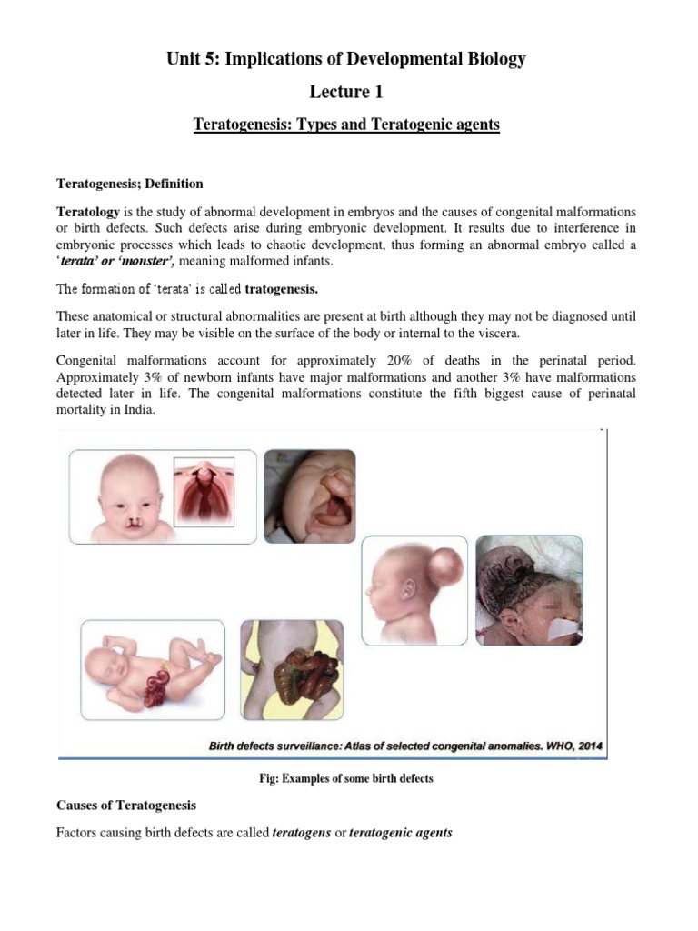 Teratogenesis Types Agents | PDF | Prenatal Development | Fetus