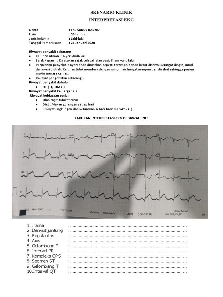 Interpretasi EKG pada CHF | PDF | Kesehatan Holistik | Gaya Hidup