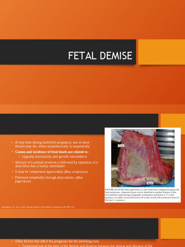 DR - JD - Gemelli - Fetal Demise | PDF | Fetus | Childbirth