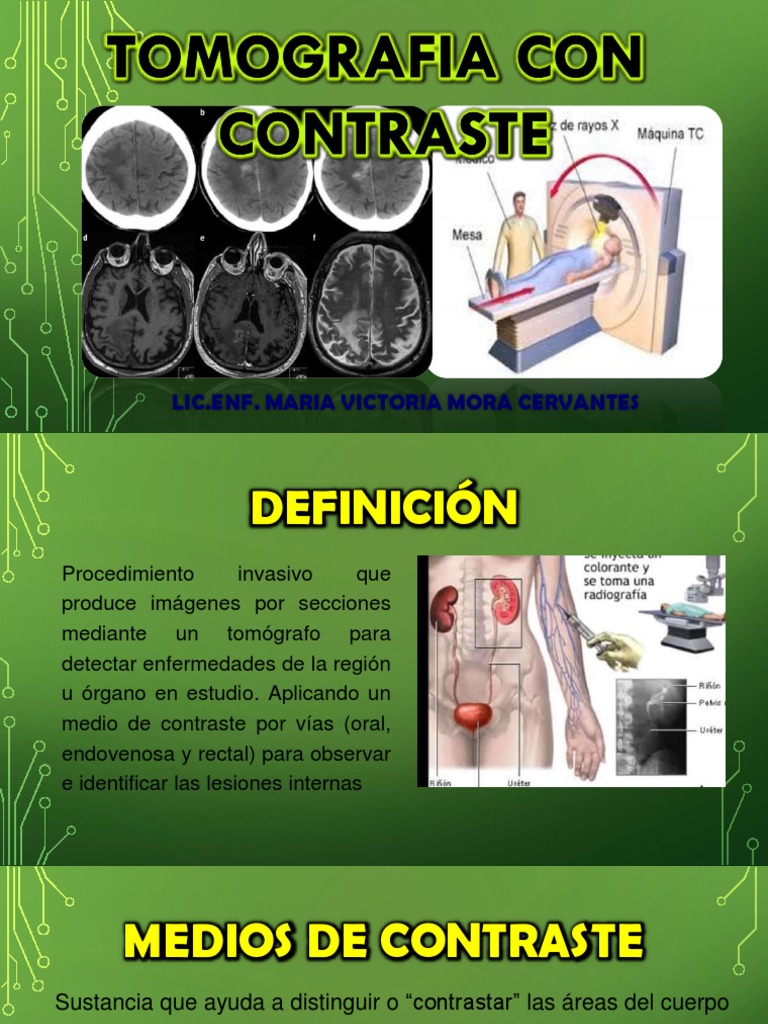Tac Con Contraste | PDF | Ct Scan | Alergia