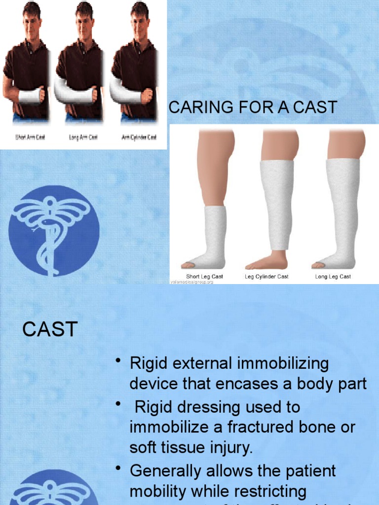 Caring for Patients with Casts: Guidelines for Assessment, Monitoring ...