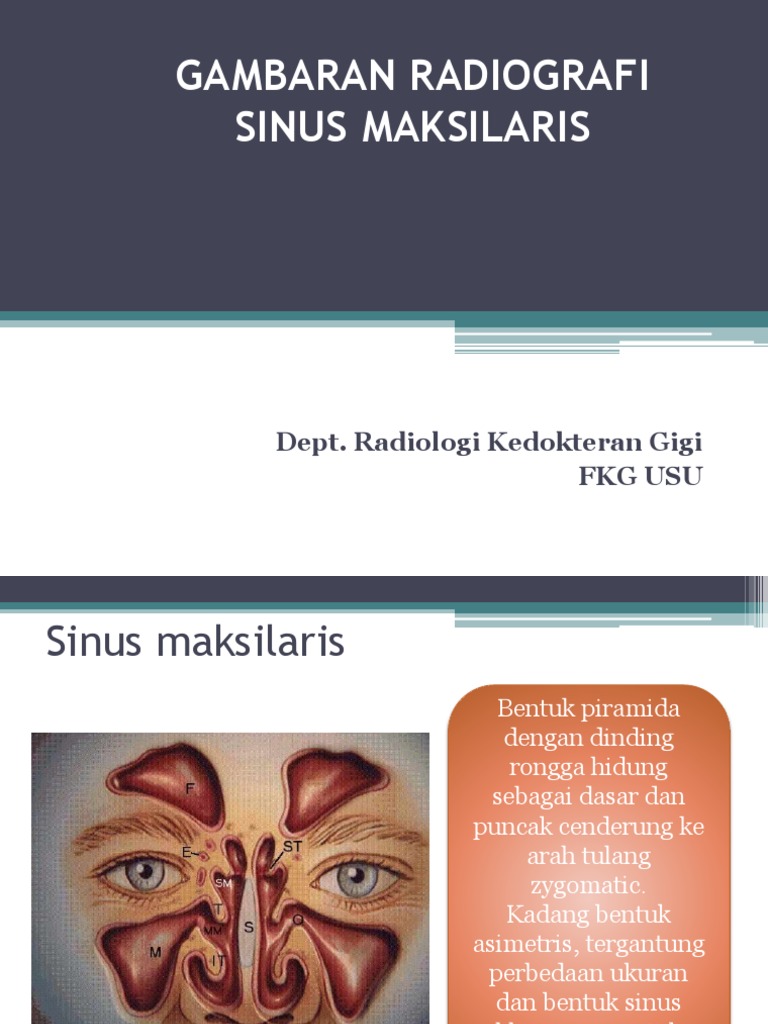 RD 4.2 Gambaran Radiografi Sinusitis | PDF
