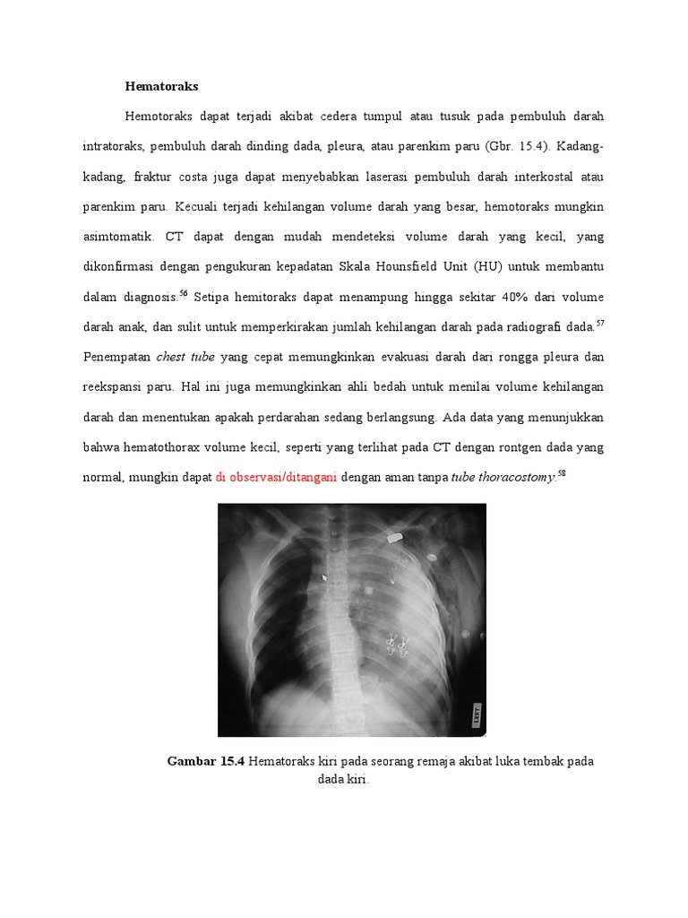 Hemotoraks: Penyebab, Diagnosis, dan Penanganan | PDF | Sains & Matematika