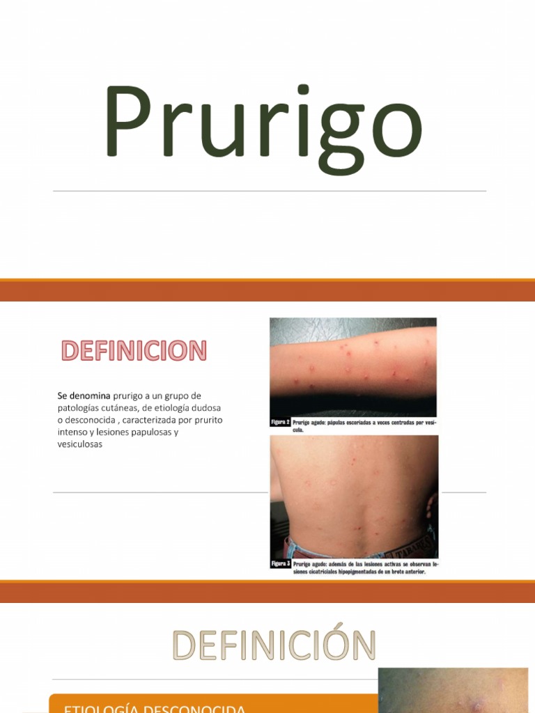 Tema 10 Prurigo | PDF | Medicina CLINICA | Enfermedades y trastornos