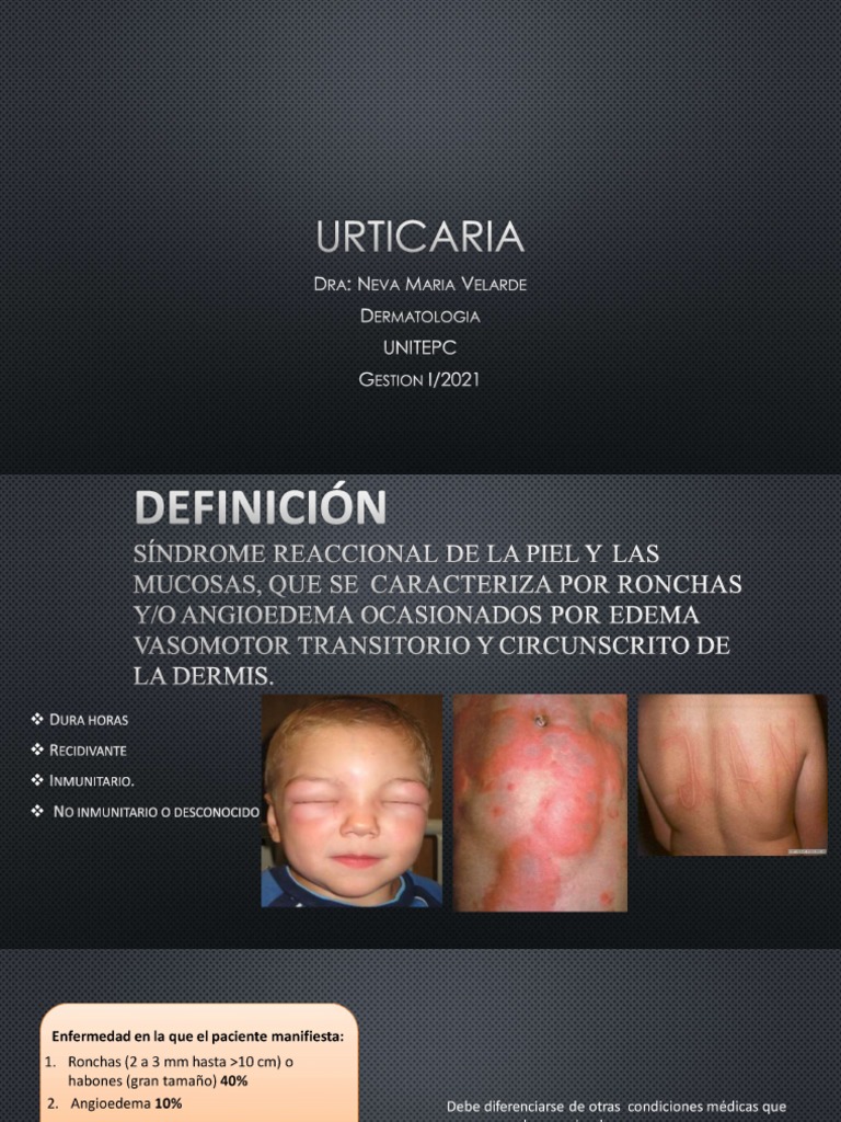 Tema 9 Urticaria | PDF | Alergia | Medicina CLINICA