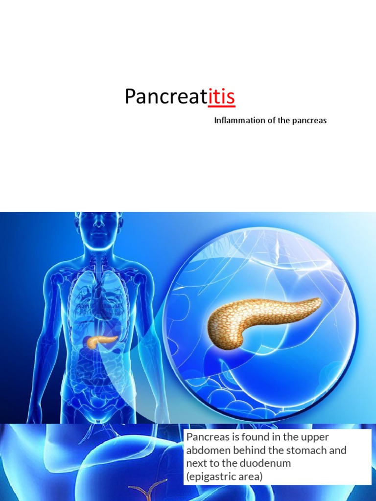 Pancreatitis - Powerpoint Presentation | PDF | Pancreas | Diseases And ...