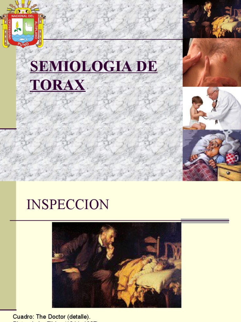 Semiología del Tórax: Inspección y Técnicas | PDF | Sistema ...
