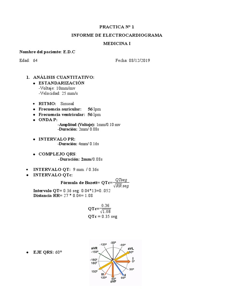 Informe de Electrocardiograma Normal | PDF