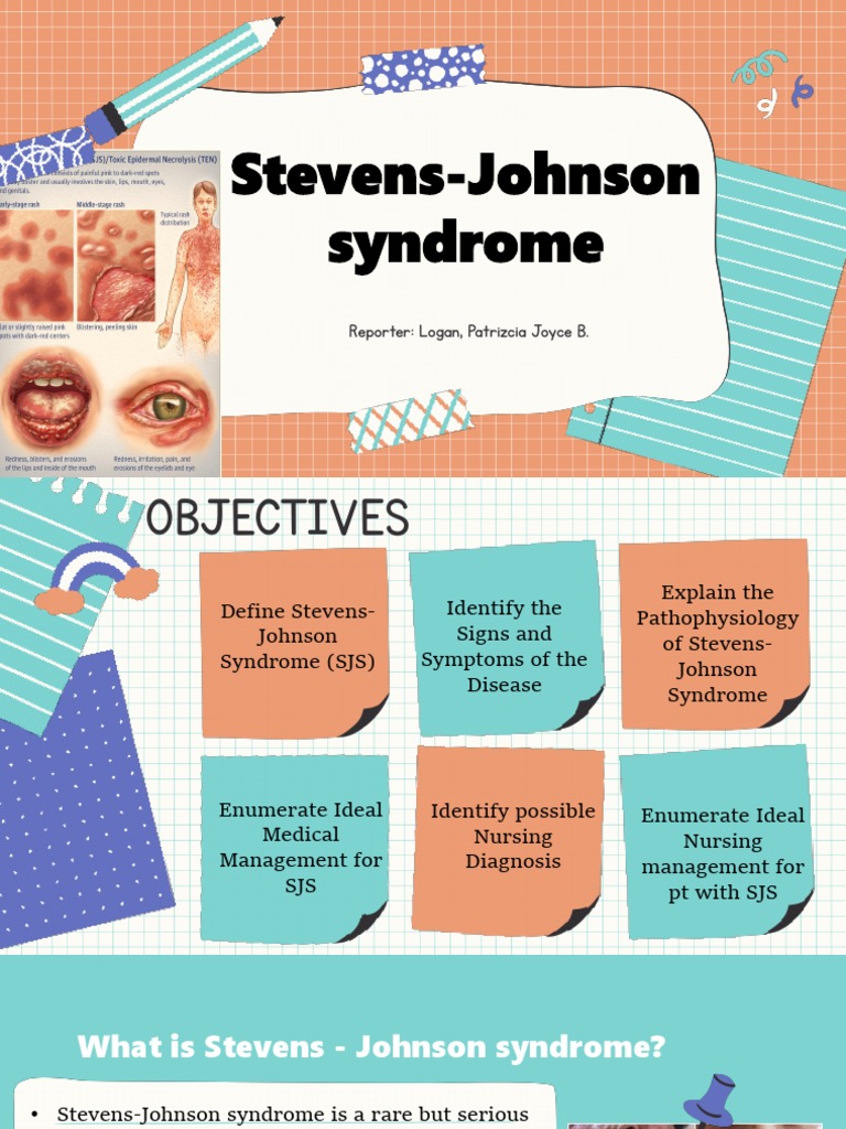 Stevens-Johnson Syndrome | PDF | Health Sciences | Epidemiology