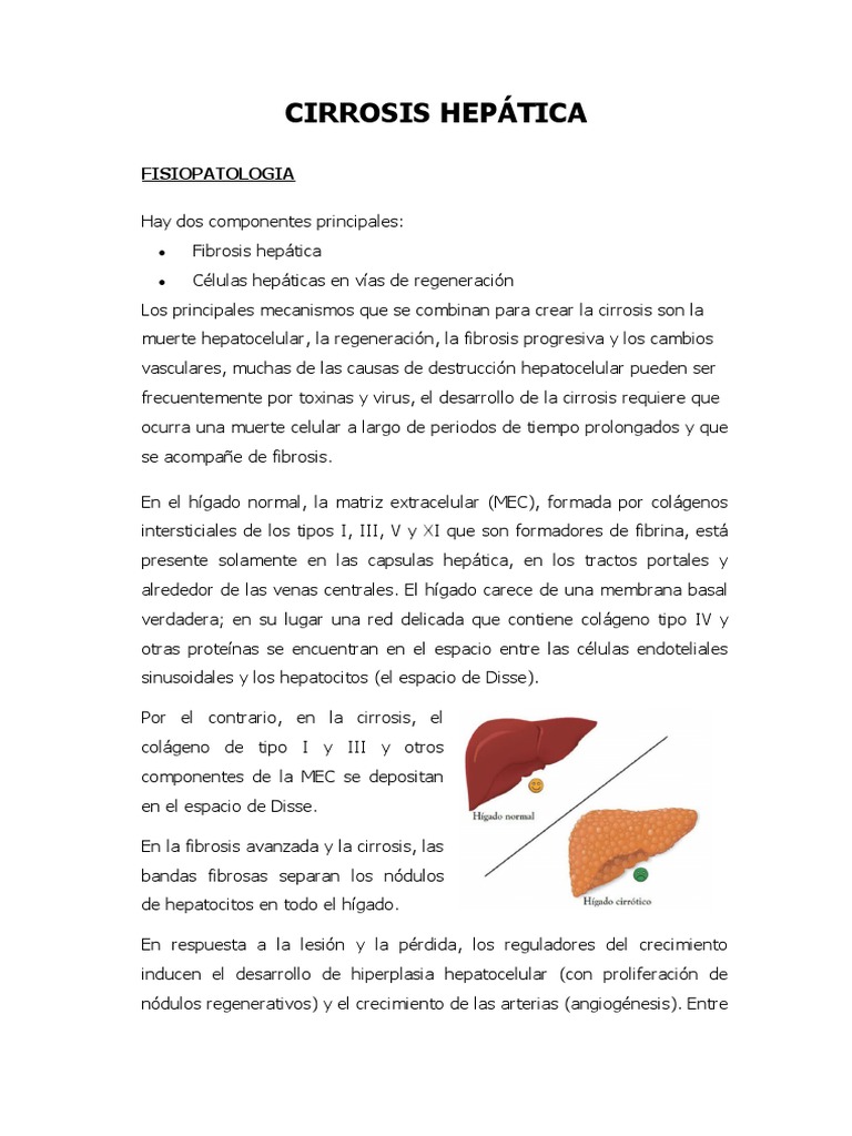 Cirrosis Hepática | Descargar gratis PDF | Cirrosis | Especialidades Medicas