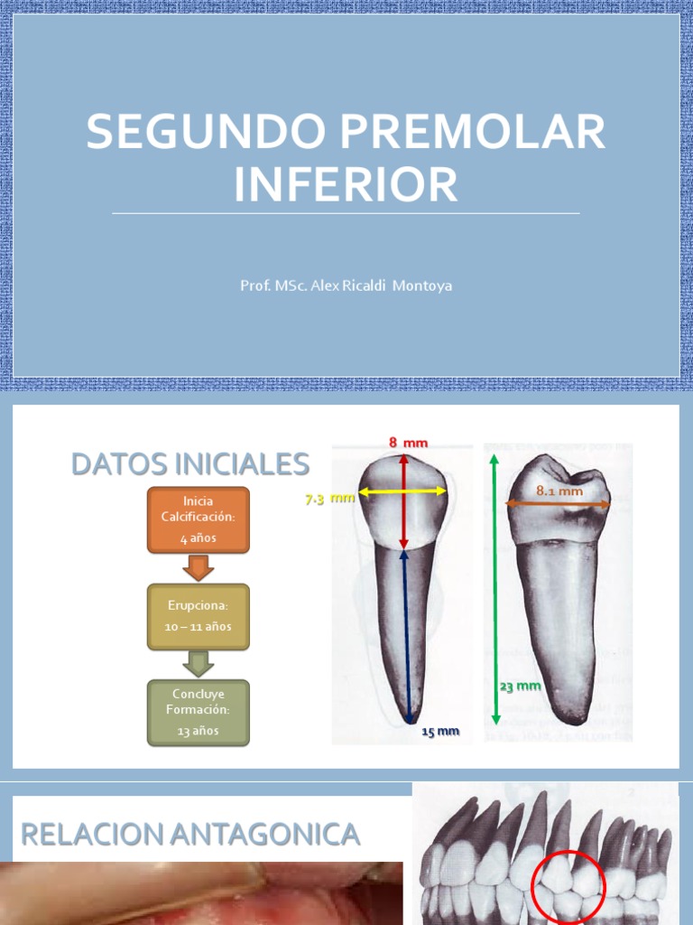 Segundo Premolar Inferior | PDF | Ramas de Odontología | Diente