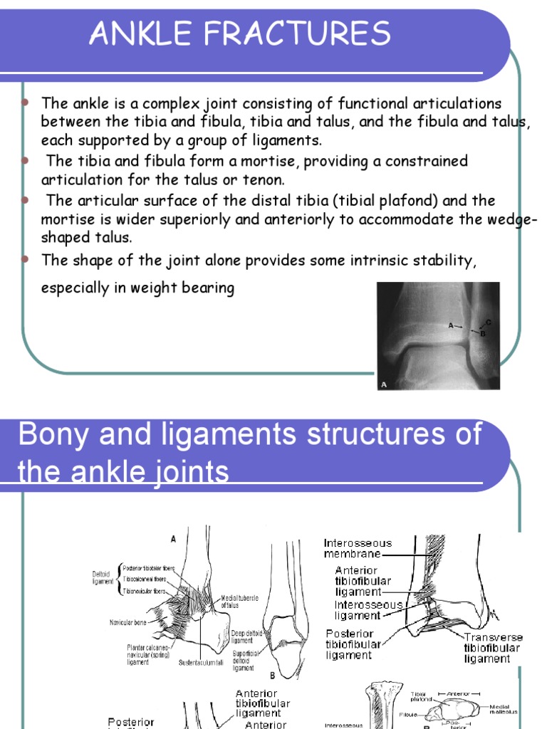 Ankle Fractures 2018 | PDF | Ankle | Foot