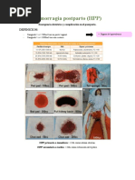 Mecanismo de Schultze | PDF | Placenta | Parto