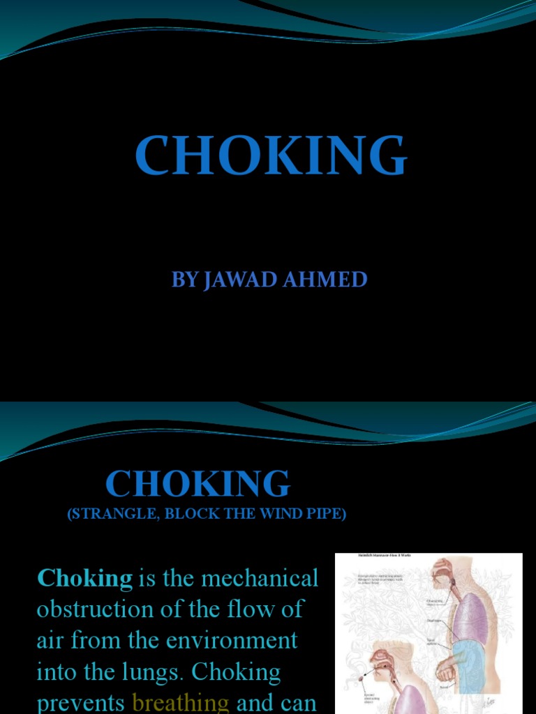 Choking: by Jawad Ahmed | PDF | Respiration | Medical Emergencies