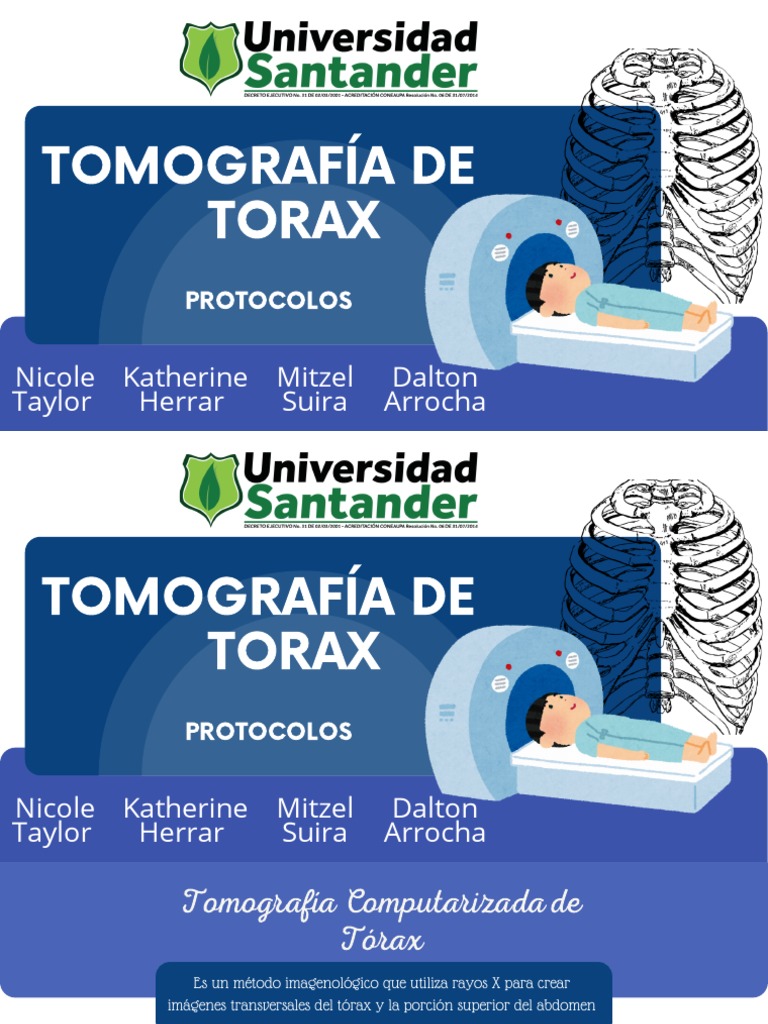 Protocolo de Torax | PDF | Ct Scan | Rayo X