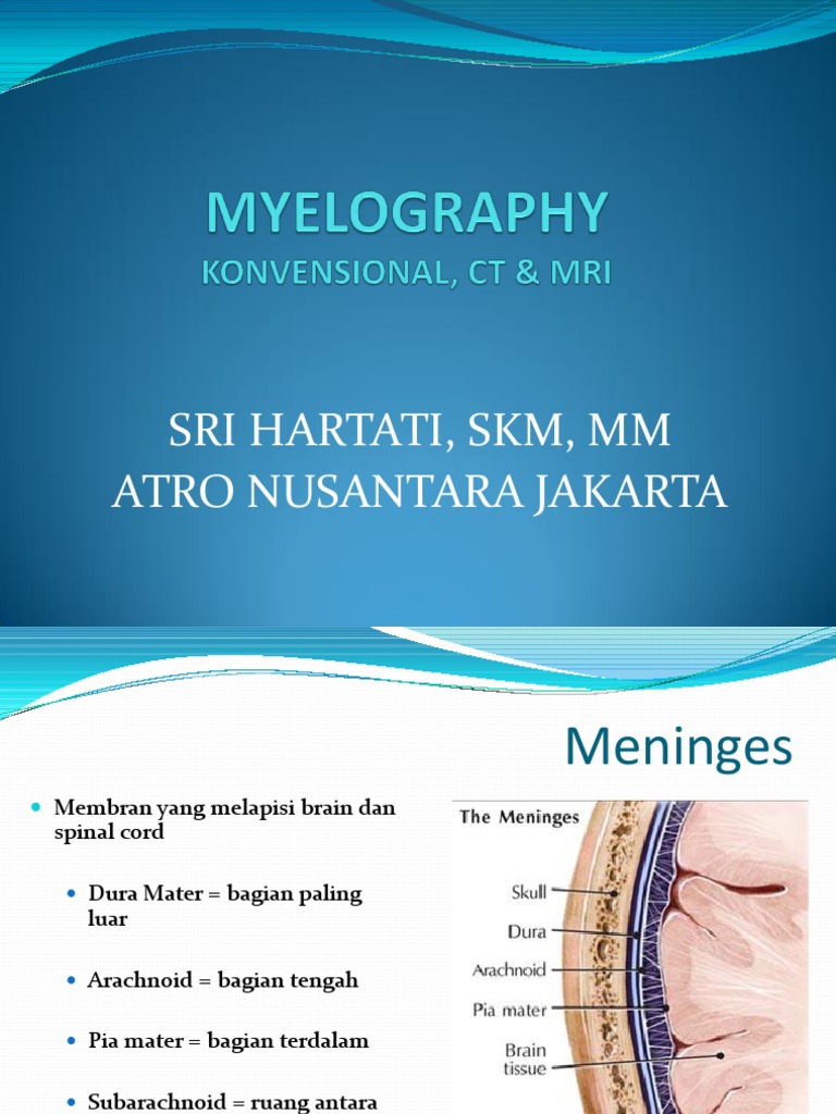 MYELOGRAPHY | PDF