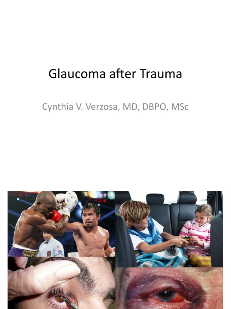 Post-Traumatic Glaucoma Insights | PDF | Glaucoma | Human Eye