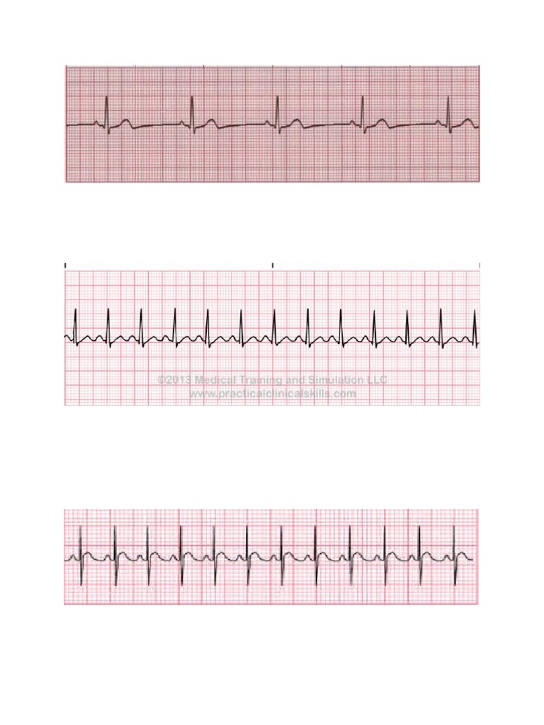 EKG Skill Station | PDF
