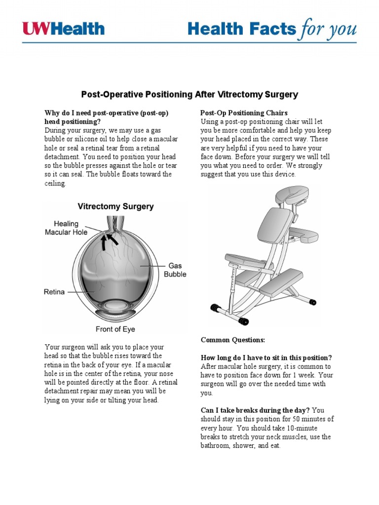 Post-Operative Positioning After Vitrectomy Surgery | PDF | Surgery ...