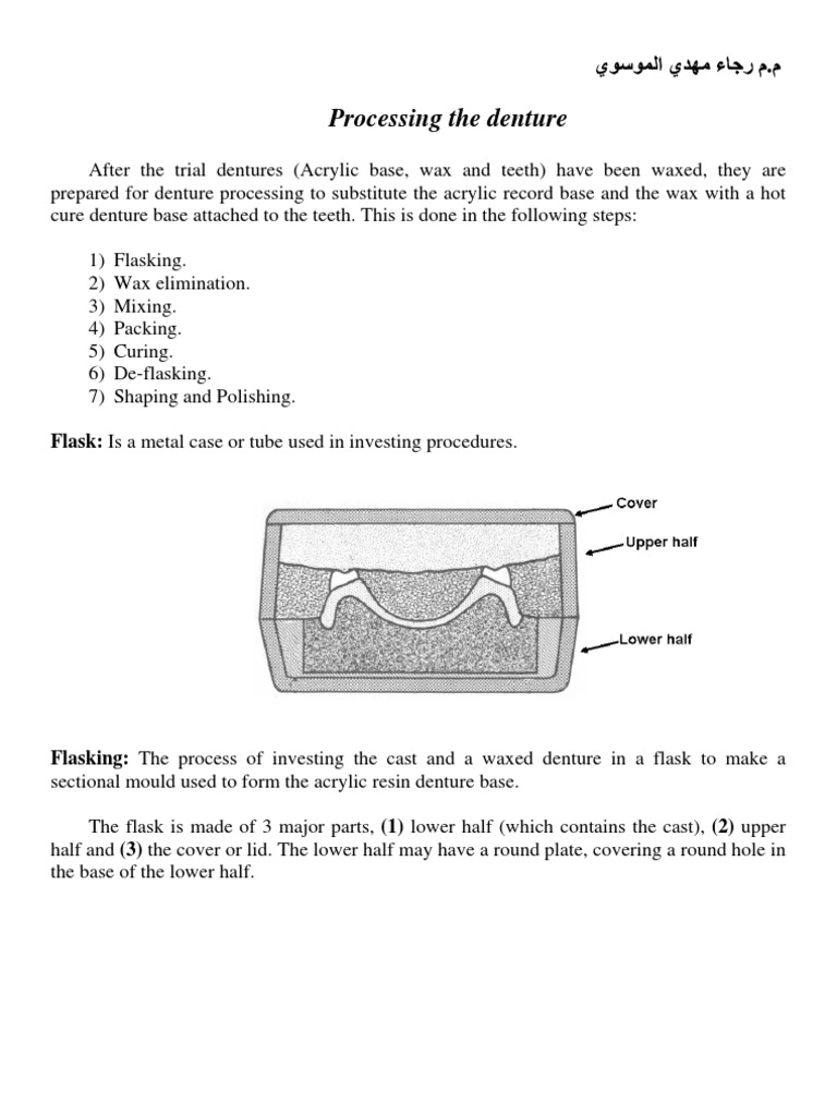 Processing the denture | Casting (Metalworking) | Dentures