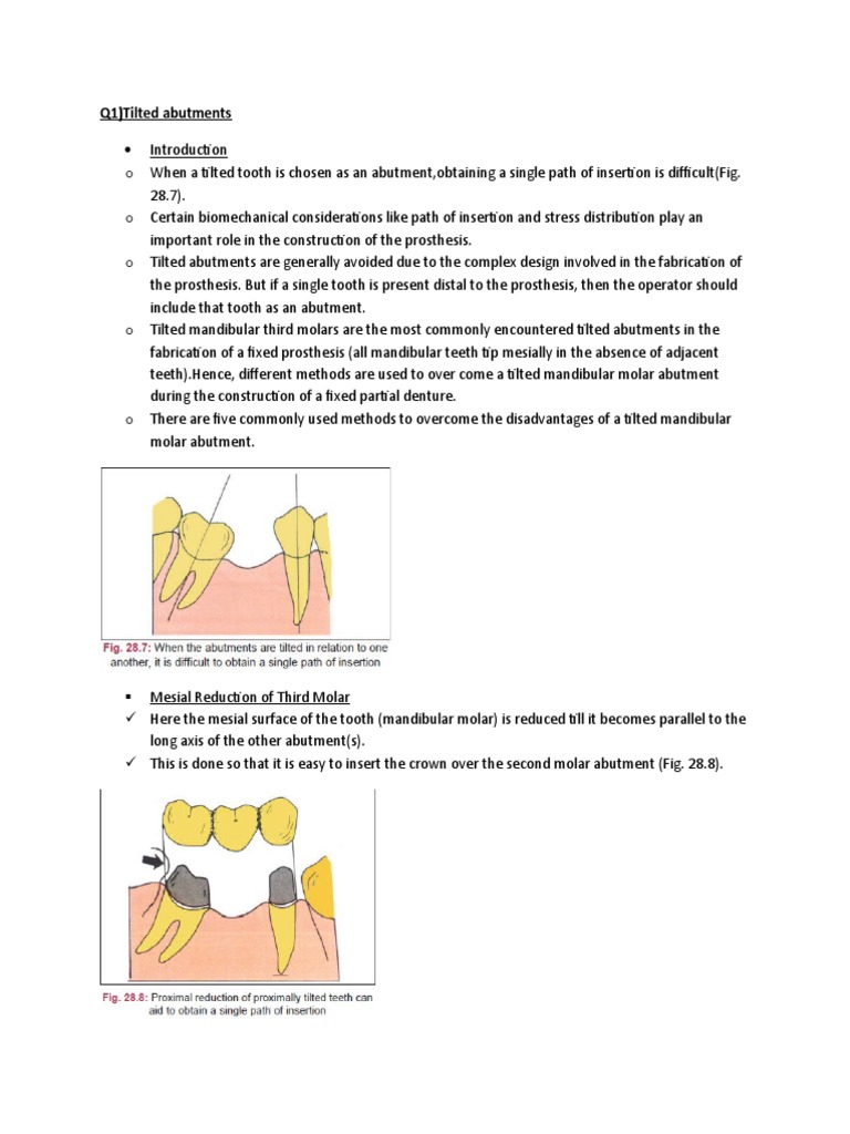 Prostho Short Notes | PDF | Dental Implant | Dentures