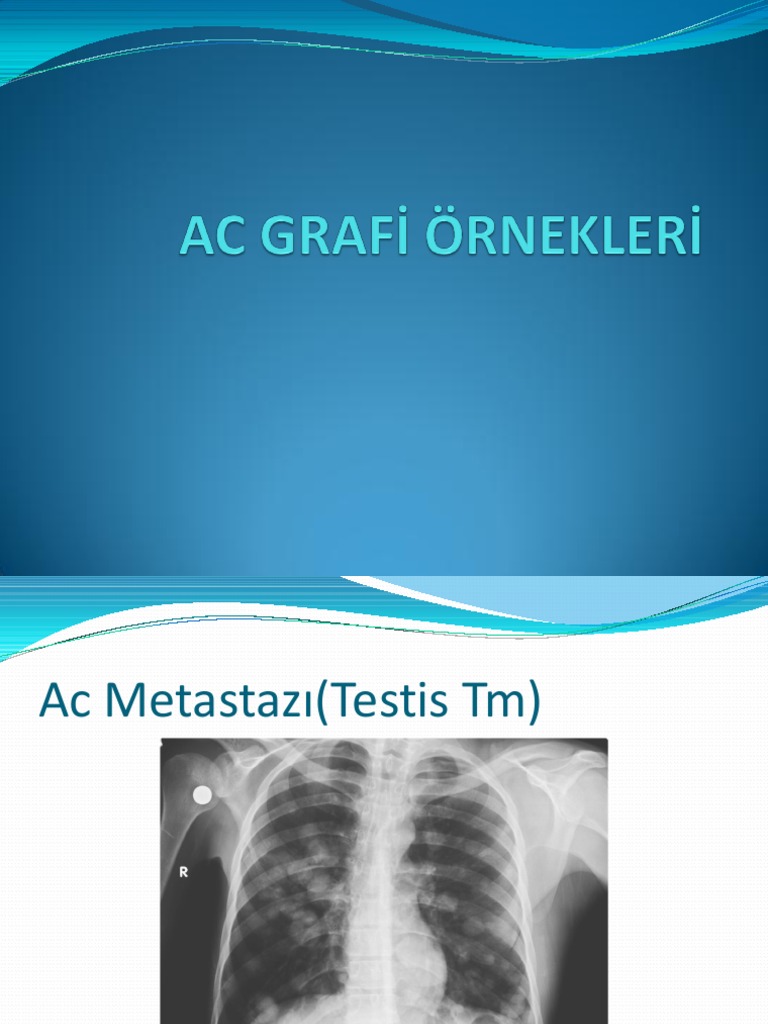 AC Grafi Ornekleri 2 | PDF