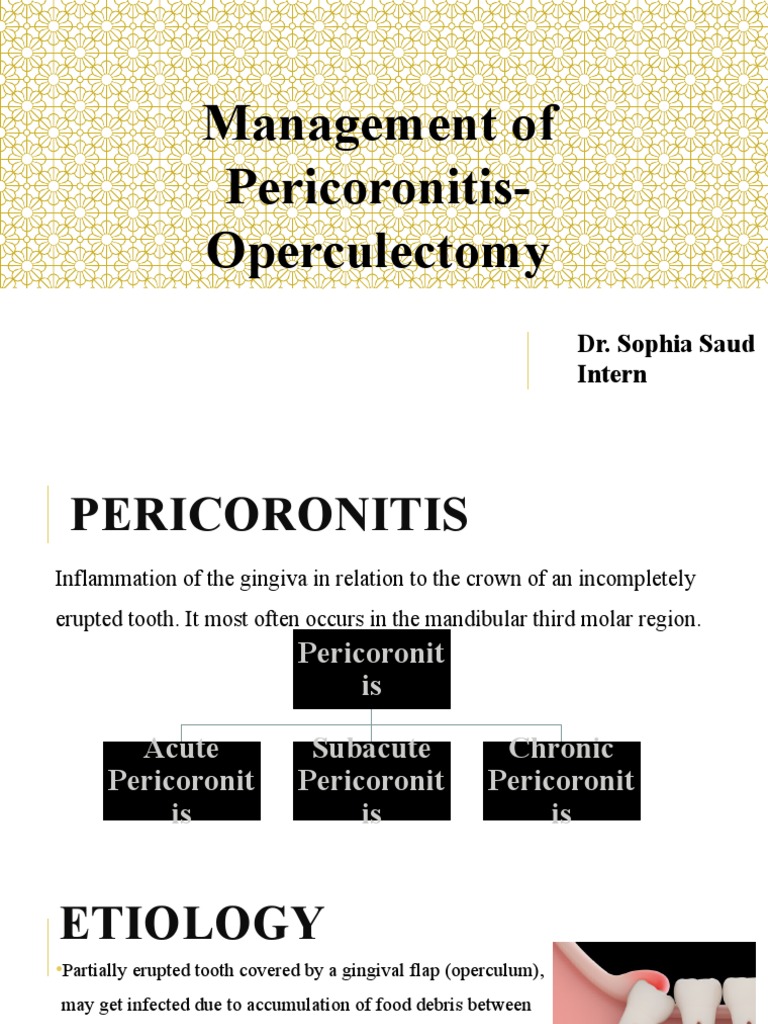 Management of Pericoronitis-Operculectomy: Dr. Sophia Saud Intern | PDF ...