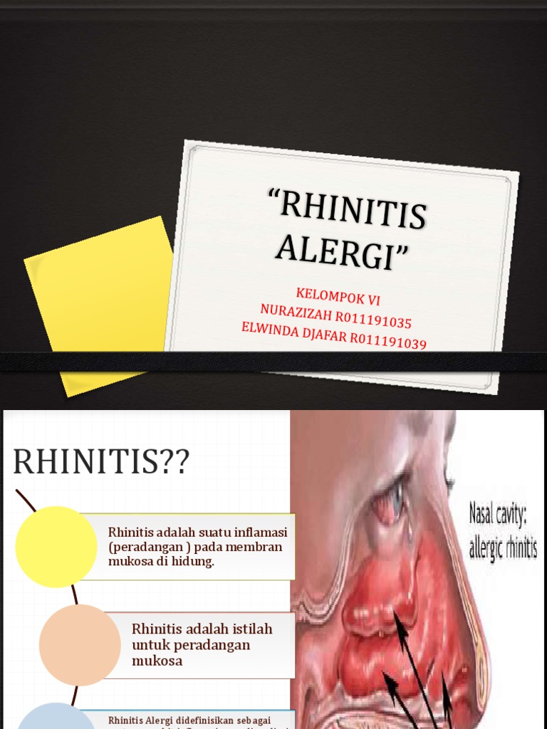 Memahami Rhinitis Alergi dan Terapi | PDF