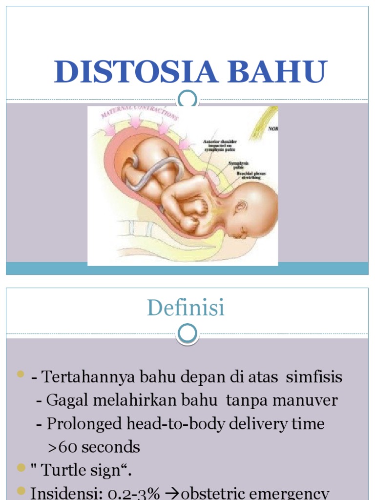 Distosia Bahu | PDF