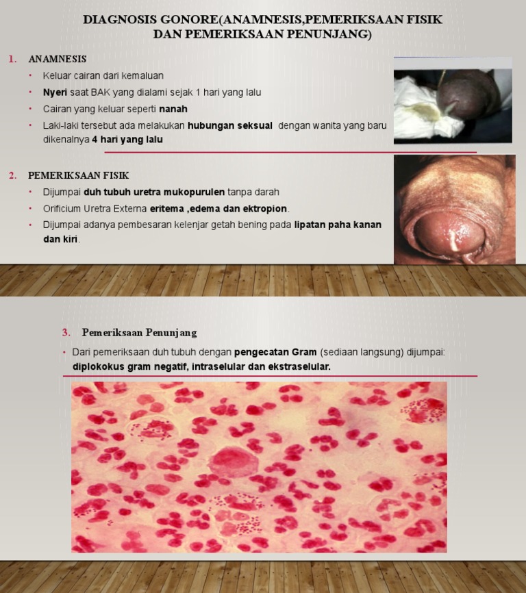 Diagnosis Gonore (Anamnesis, Pemeriksaan Fisik Dan Penunjang) | PDF | Pengembangan Diri | Sains ...