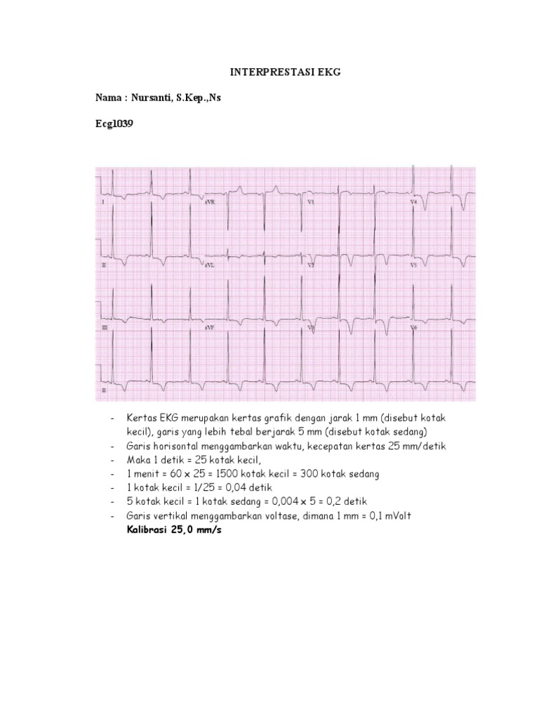 Interprestasi Ekg Tugas Akhir | PDF | Sains & Matematika