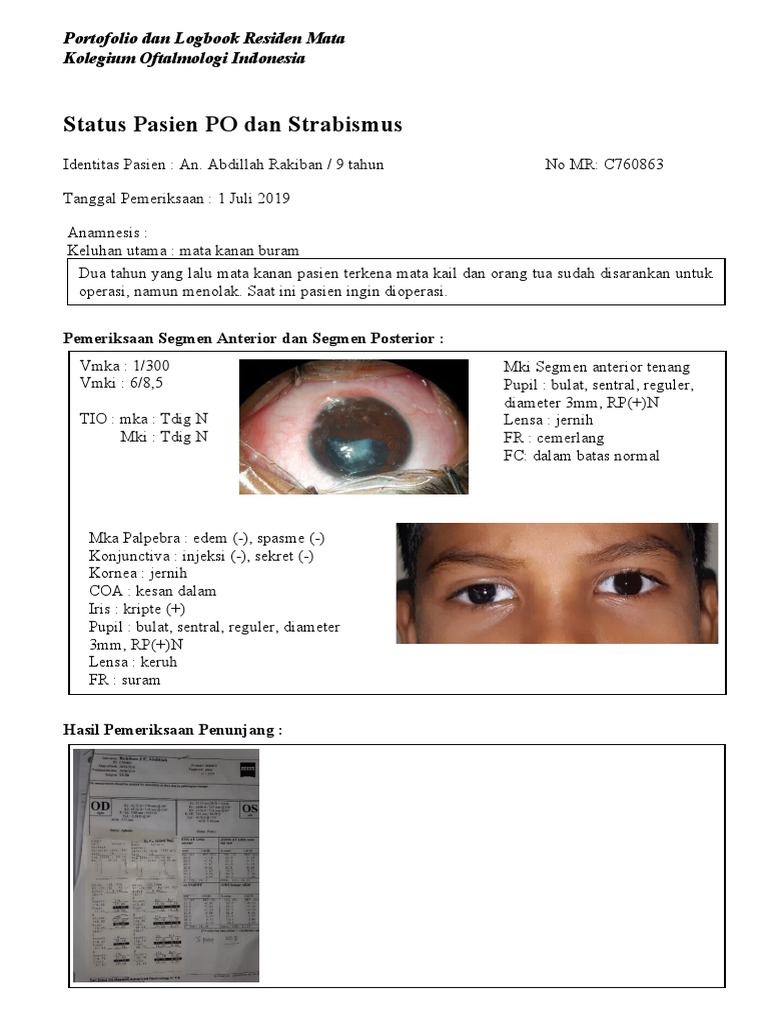 Status Pasien PO Dan Strabismus: Portofolio Dan Logbook Residen Mata ...