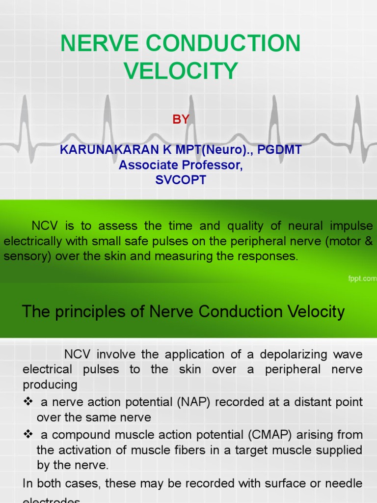 Nerve Conduction Velocity: Karunakaran K MPT (Neuro) ., PGDMT Associate ...