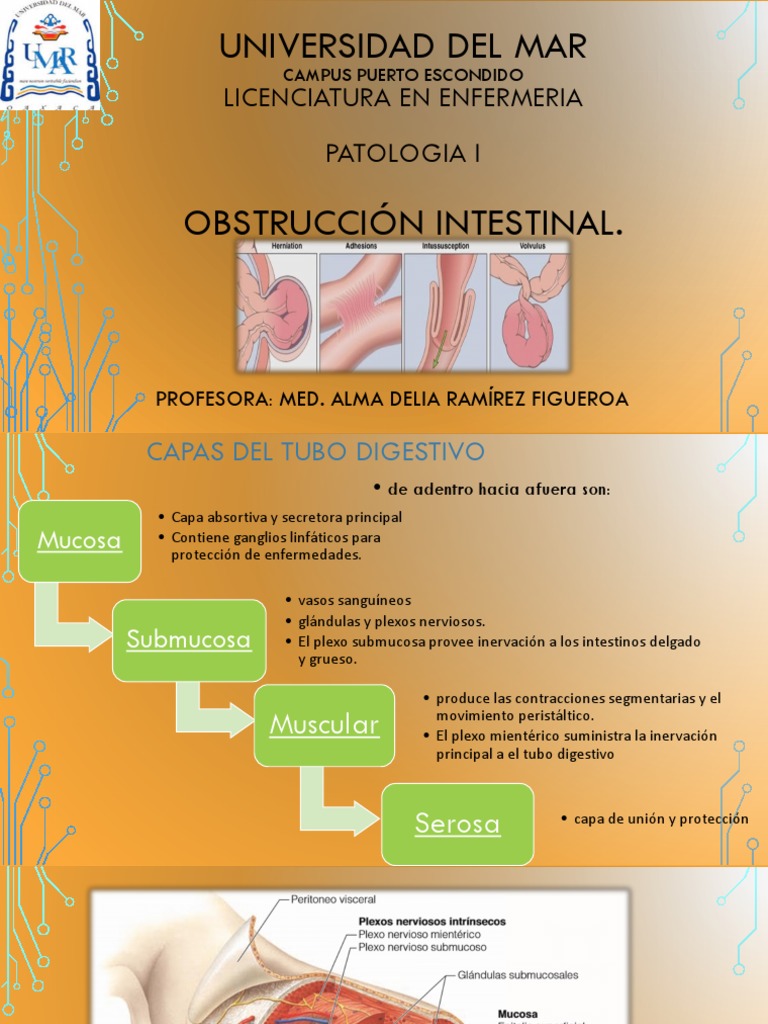 Obstruccion-Intestinal 2021 | PDF | Intestino delgado | Sistema ...