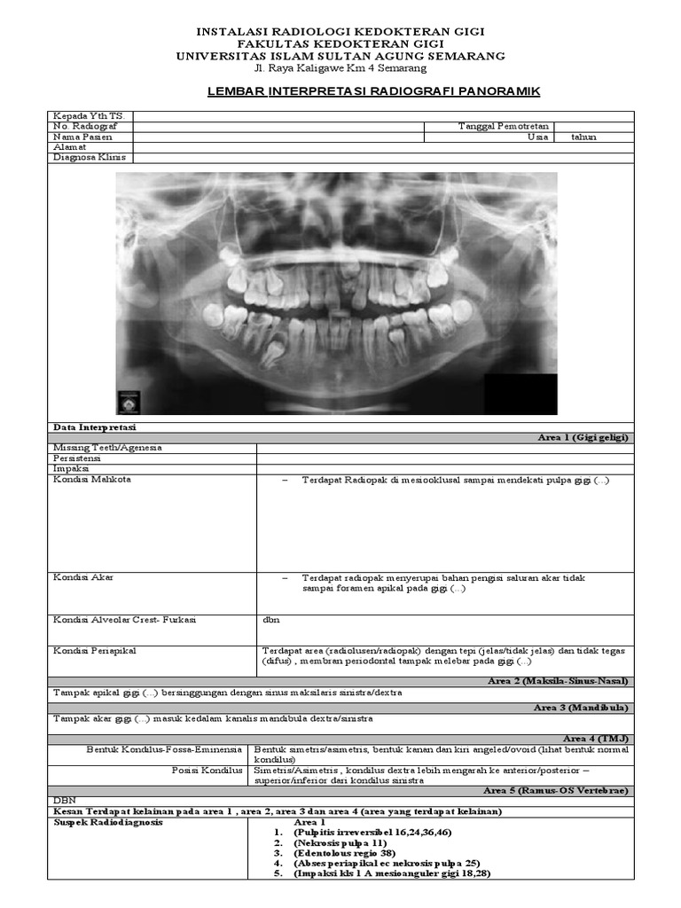DIAGNOSIS DAN KELAINAN GIGI BERDASARKAN INTERPRETASI RADIOGRAFI ...