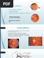 Fondo de Ojo Normal | PDF | Ojo humano | Percepción visual